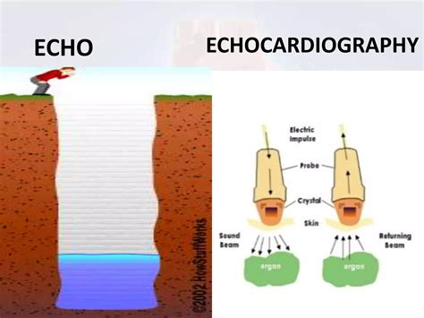 Measurement Of Cardiac Output Pptx