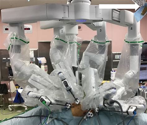 Final Appearance After Robot Setup In Robot Assisted Thoracoscopic Download Scientific Diagram