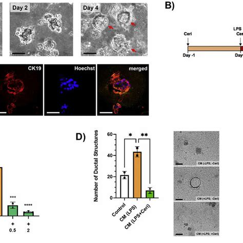 A Primary Pancreatic Acinar Cells From Kc Mice Were Isolated And Download Scientific Diagram