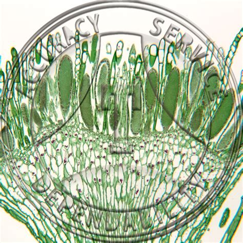 Mnium Median Antheridium Prepared Microscope Slide