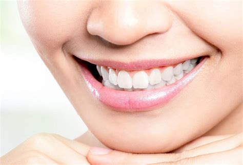 بلیچینگ دندان لبخند سپید شرق خدمات سفید کردن دندان ها بلیچینگ دندان