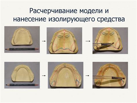 Изготовление индивидуальных ложек и окклюзионных валиков - презентация ...