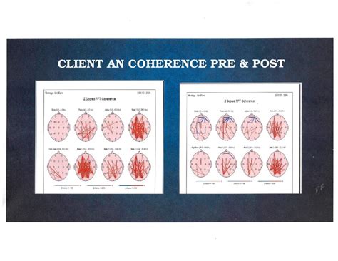 QEEG Analysis Brain Mapping Neurofeedback Integrated Therapy Institute