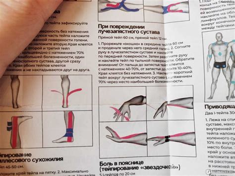 Тейпирование живота: как это работает, виды и схемы, как выбрать тейпы
