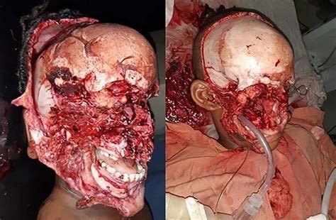 【超！閲覧注意】ハイエナ（噛む力450kg）に襲われた女子小学生、おぞましい状態で見つかる ポッカキットポッカキット