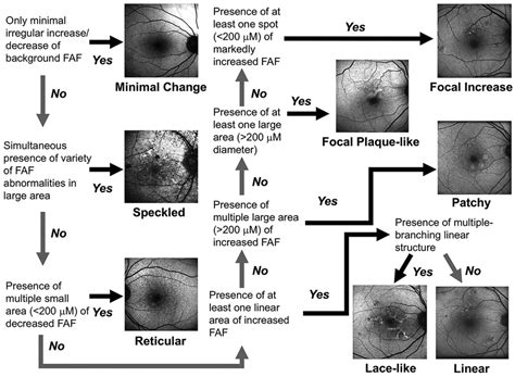 Flow Chart For Classifying Abnormal Faf Download Scientific Diagram Flow Chart For Classifying Abnormal Faf Download Scientific Diagram