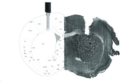 Histology And Stereotaxic Location Of Electrodes On The Right Is A
