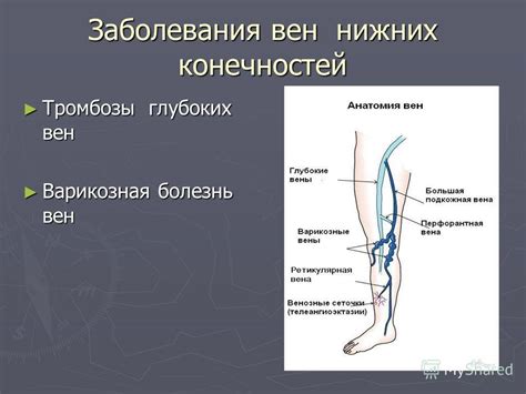 Презентация на тему Облитерирующие заболевания артерий Атеросклероз