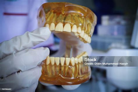인공 아래턱을 들고 치과 의사 치과 보철물 치아 플레이트 치과 치료 학교에서 학생을 가르치기 위한 치과 모델 의료 개체 틀니에 대한 스톡 사진 및 기타 이미지 Istock