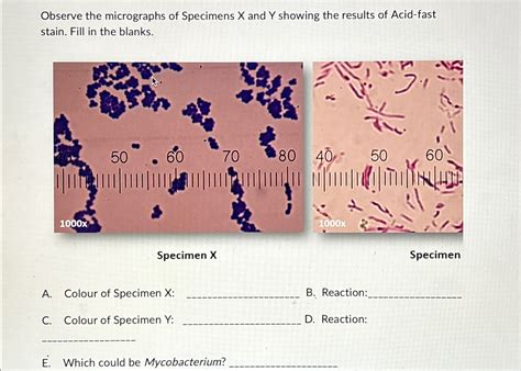 Solved Observe The Micrographs Of Specimens X ﻿and Y