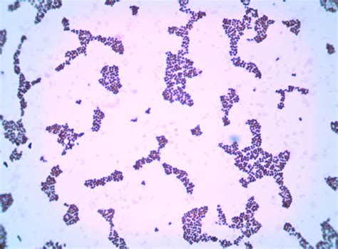 Lab Practical 2 Staining Flashcards Quizlet
