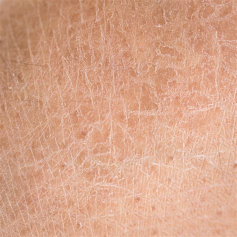 About Skin Archives E