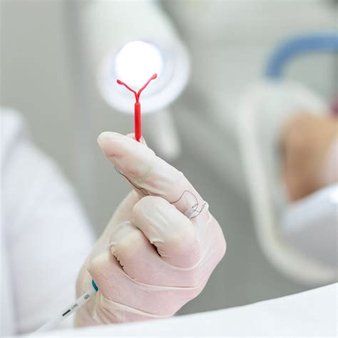 Mirena Iud Birth Control Procedure Effects • Otco Poland