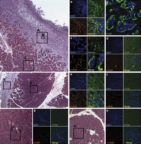 Immunohistochemical Co Localization Of Ctgf α Sma And Desmin To