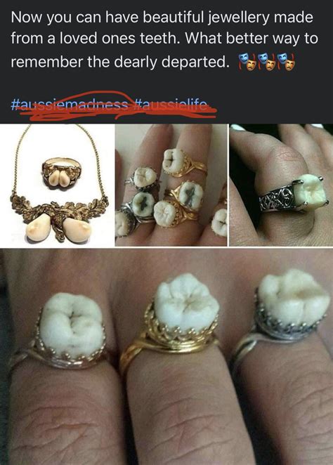 Thanks I Hate Teeth Jewelry R Tihi