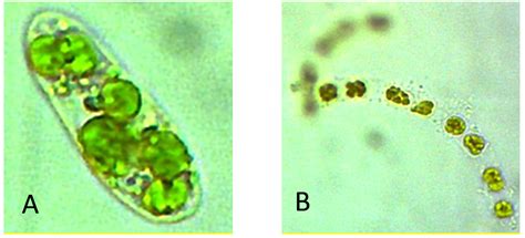 Euglena 1000x