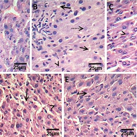Photomicrograph Of Hematoxylin And Eosin Stained Liver Sections From
