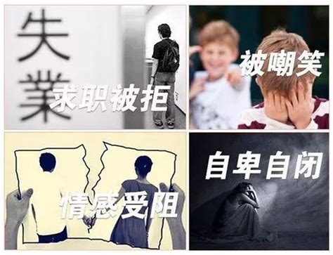 您的白斑確診了嗎？白癜風查的准才治得好，中秋專家會診 公益普查預約中 每日頭條
