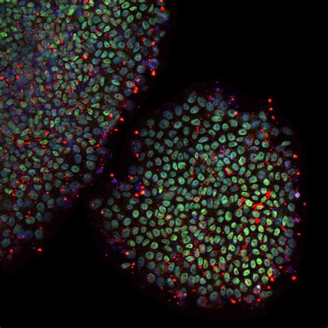 How To Measure Cell Culture Confluency Cell And Gene Therapy Catapult
