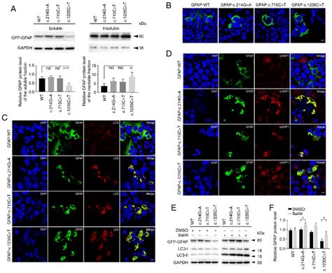 Functional Analysis Of Mutant Gfap A Relative Protein Levels Of Gfap
