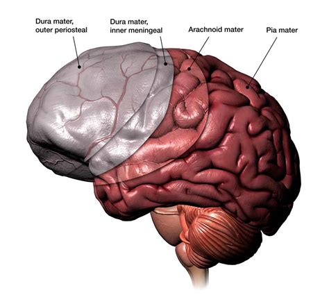 Subdural Vs Epidural Hematomas Diller Law Personal Injury Law