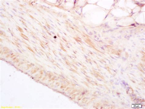 Phospho Hsp27 Ser78 Polyclonal Antibody Bs 3179r