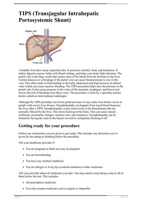 PDF TIPS Transjugular Intrahepatic Portosystemic Shunt