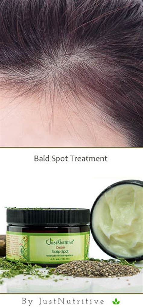 Scalp Spot Cream Treatments Just Nutritive