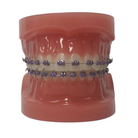 B 🧚🏽‍♀️💕 Braces Colors Cute Braces Cute Braces Colors