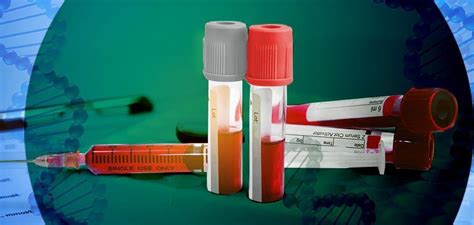 Hemofilia O Que é Sintomas Diagnóstico E Tratamento Medprev