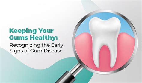 Keeping Your Gums Healthy Early Signs Of Gum Disease