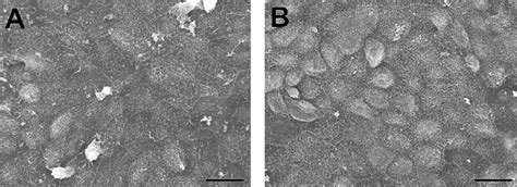 Behavior Of Fetal Rpe On Bruchs Membrane After Freeze Thaw And Cm Download Scientific Diagram