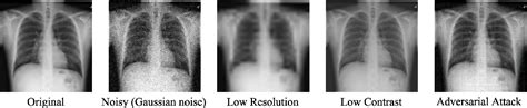 Figure 1 From Improving Robustness And Reliability In Medical Image Classification With Latent
