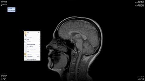 Microdicom Free Dicom Viewer Software For Windows