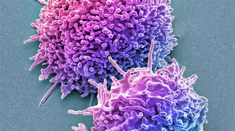 Ovarian Cancer Cells