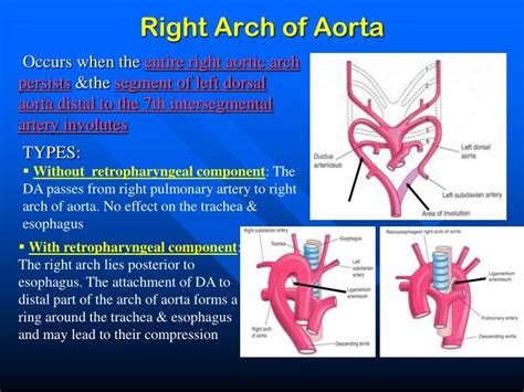 Ppt The Aortic Arches Powerpoint Presentation Id 2090347