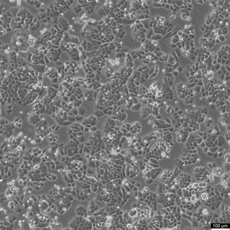 Nci H1975 Cells