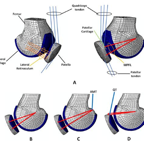 A Parametric Geometry Of The Pfj Femur Patella And Femoral And