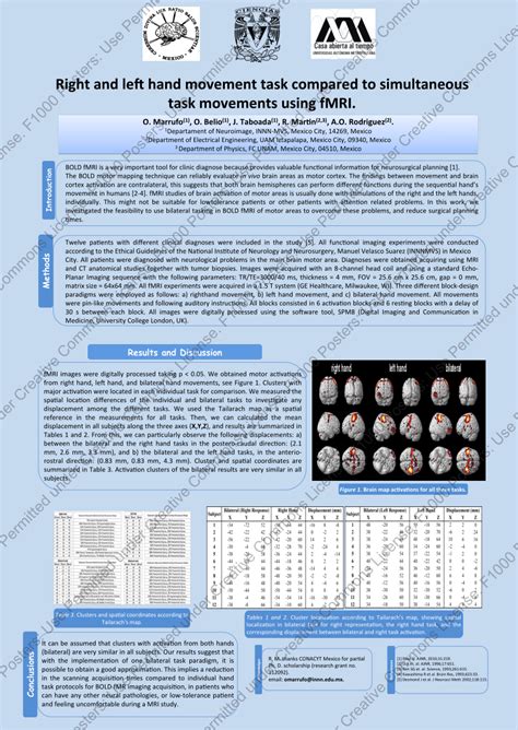 Pdf Right And Left Hand Movement Task Compared To Simultaneous Task Movements Using Fmri