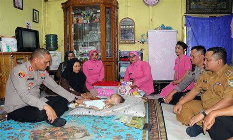 Haru Kapolres Dan Bhayangkari Asahan Sambangi Bayi Penderita Hidrosefalus MedanMerdeka