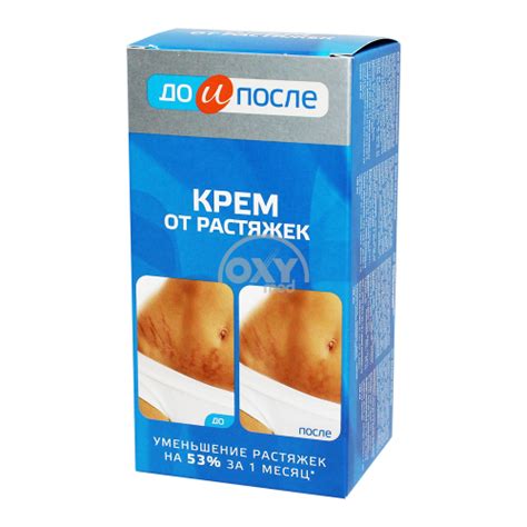 Крем До и после от растяжек 100 мл купить в Ташкенте онлайн по