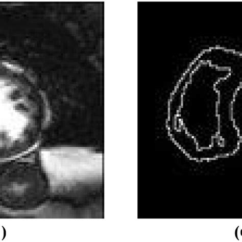 Rv Manual Segmentation In Yellow A Endocardial Detection B Download Scientific Diagram