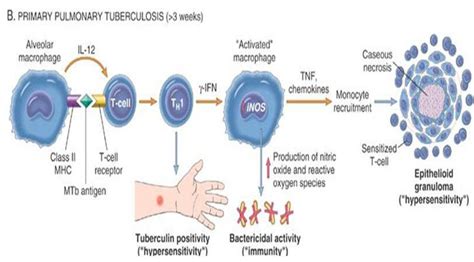 Pathophysiology Of Tuberculosis An Update Review