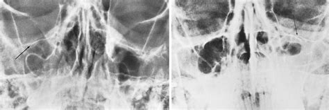 The Facial Bones Clinical Tree