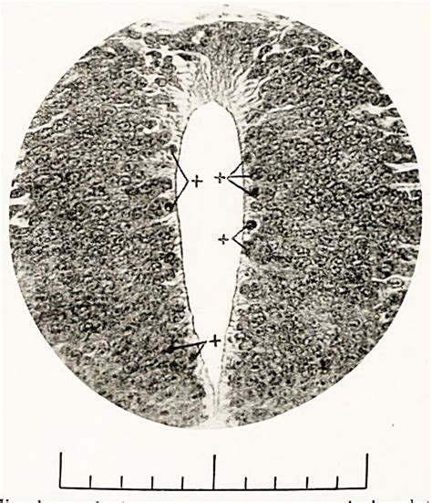 Figure 2 From A Study Of The Structure And Function Of The Interstitial