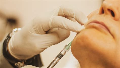 Preenchimento Facial O Que é Para Que Serve Contraindicações E Como