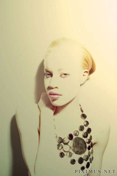Diandra Forrest Afro American Albino Model Celebrities