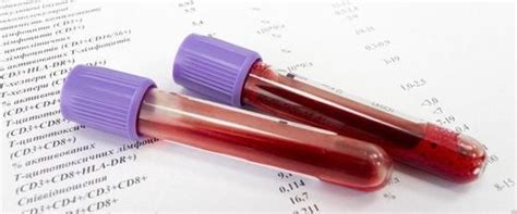 Tìm hiểu về các xét nghiệm lipid máu Vinmec