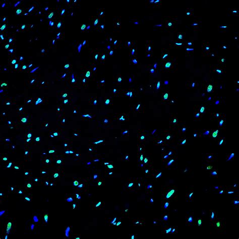 Tunel 1 Step In Situ Apoptosis Kit Fitc Assay Genie