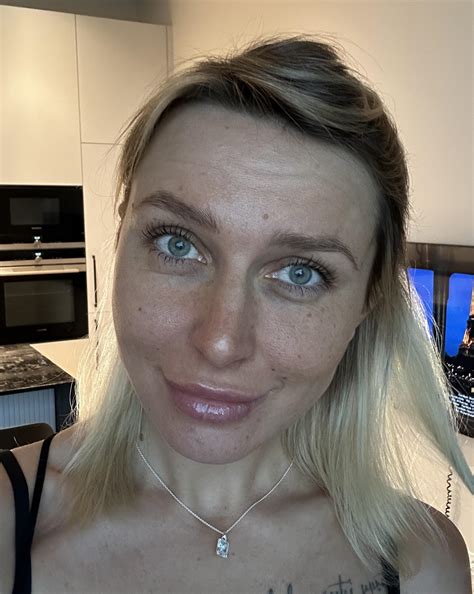 The Face Of A Freckled Girl Embracing Her Natural Beauty Sexy